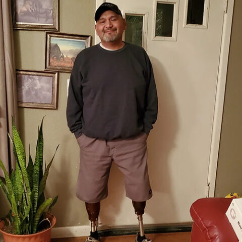 Home | Limbs For Life